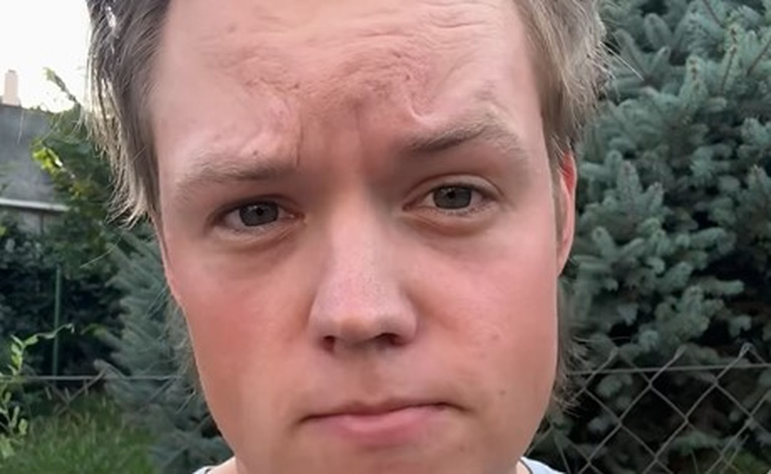 Amerikanac iz Supertalenta odgovorio na prozivke da si je sam oštetio ...