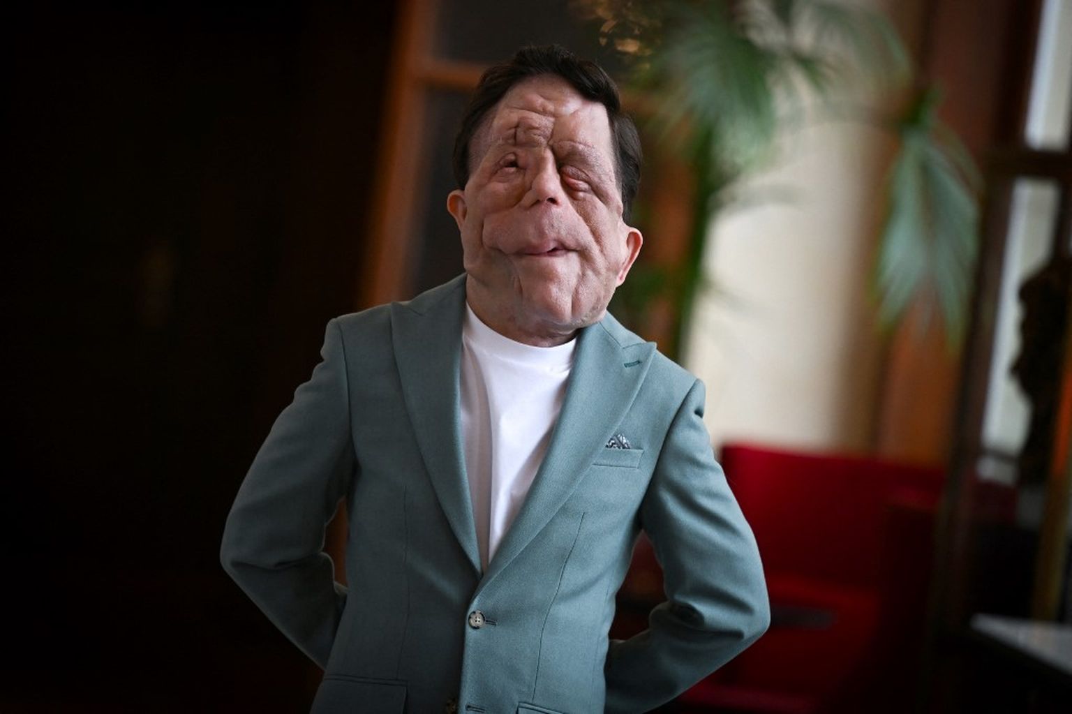 Životna priča glumca koji je izgradio uspješnu karijeru unatoč svim ...