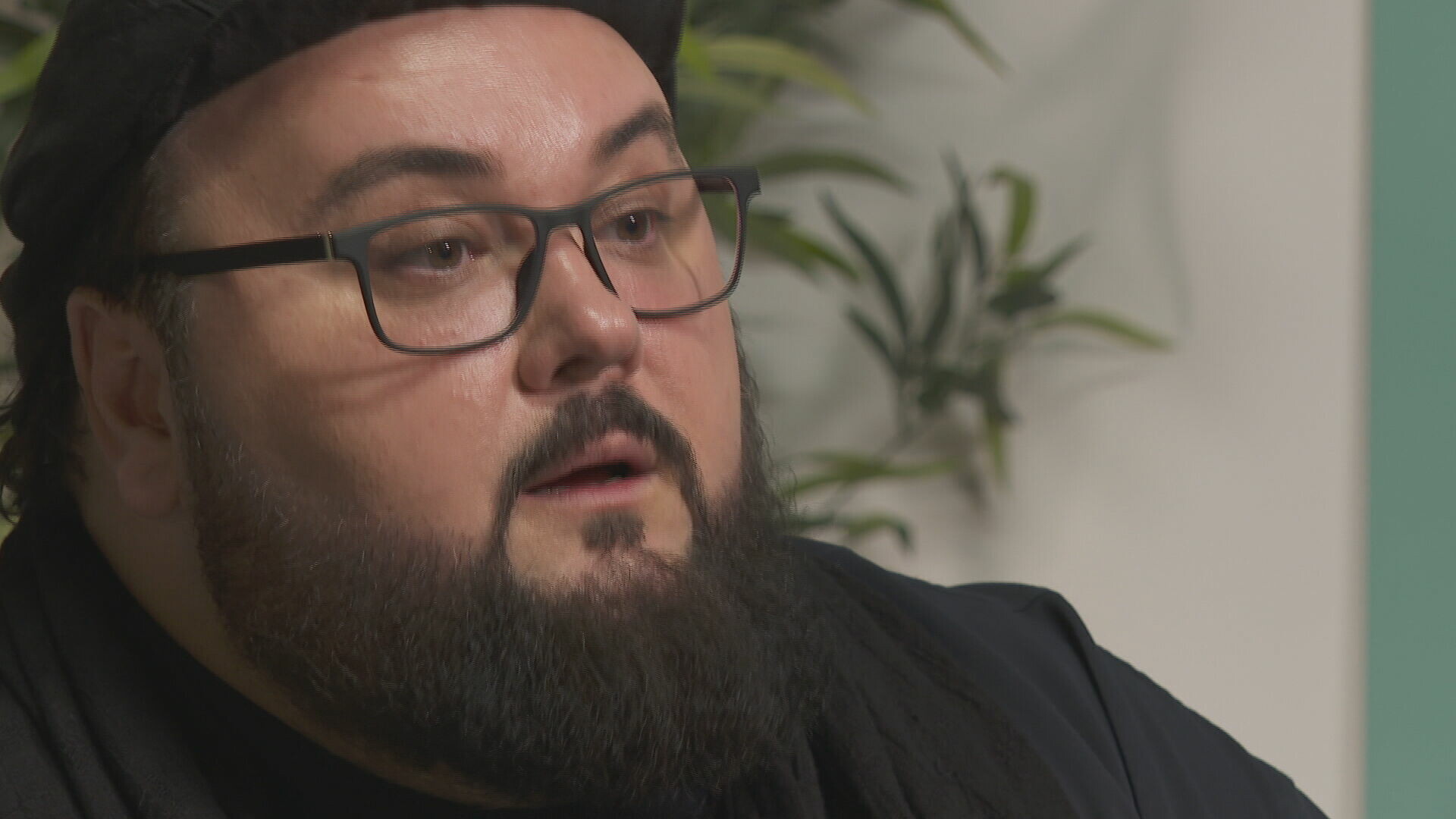 Houdek se podvrgnuo estetskom zahvatu na koji se muškarci sve češće ...