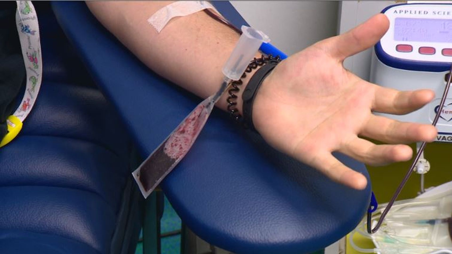 U Rijeci nedostaje zaliha krvi, pozvani darivatelji