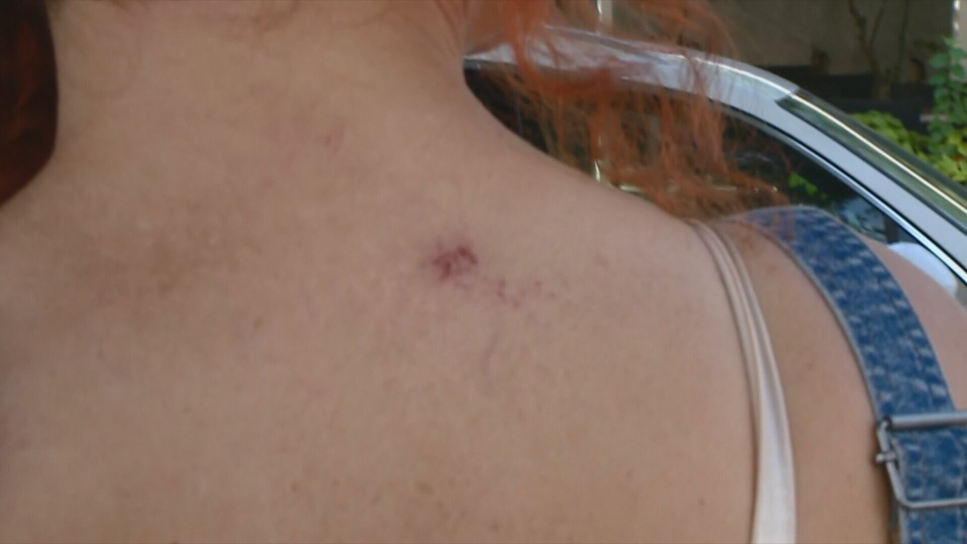 Sićušni nametnici kojih se teško riješiti uznemiruju građane: "Ostaju ...