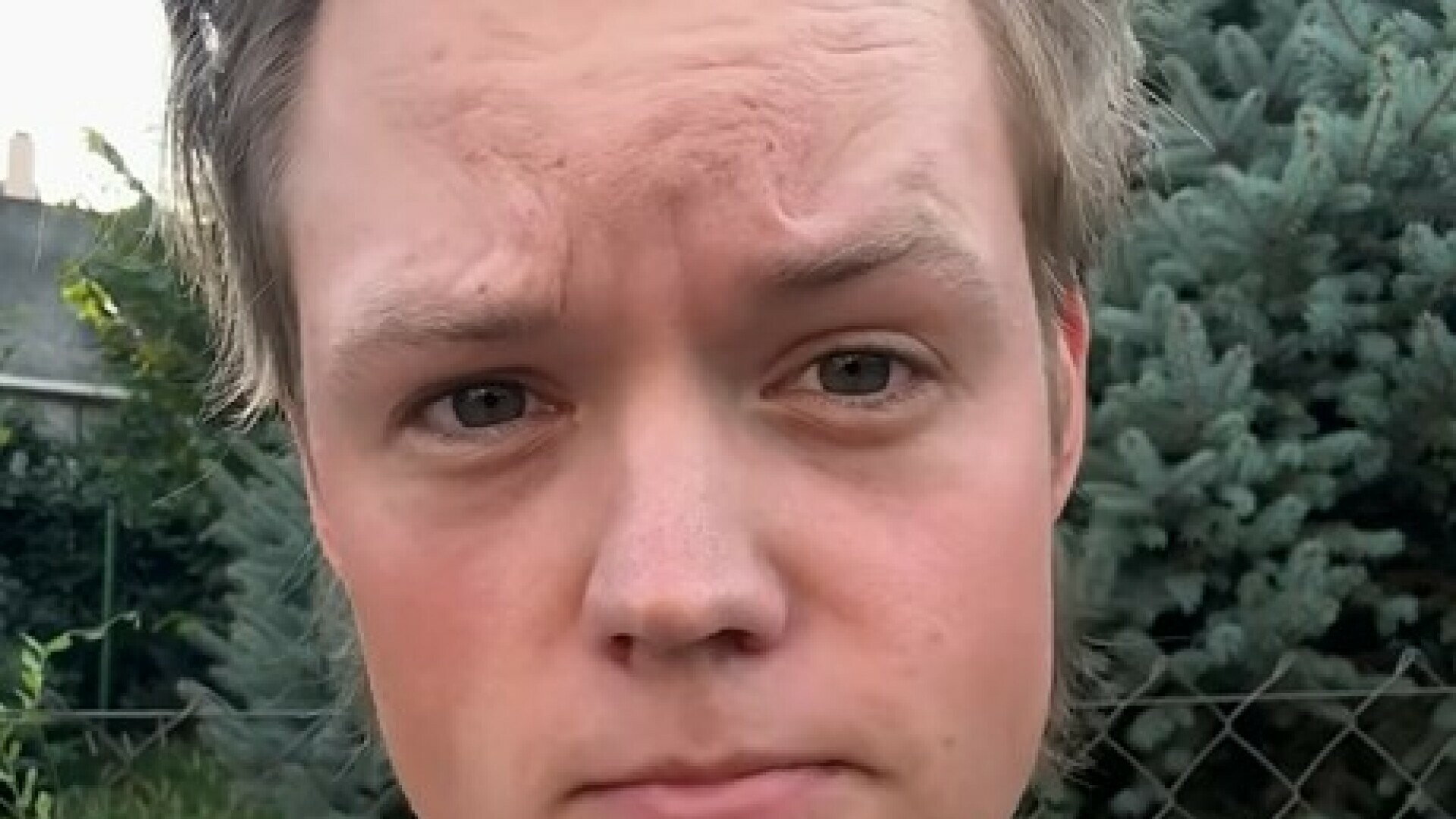 Amerikanac iz Supertalenta odgovorio na prozivke da si je sam oštetio ...