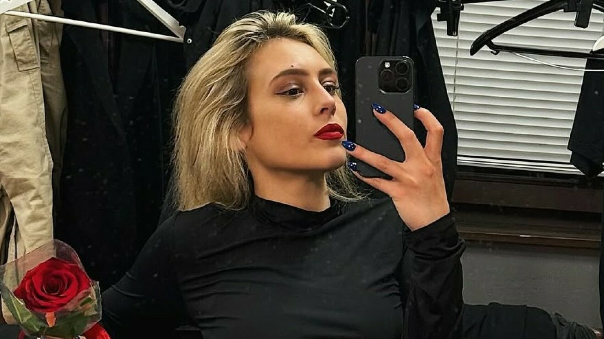 Zvijezda Kumova završila u gipsu, fotku iz bolnice podijelila je na ...