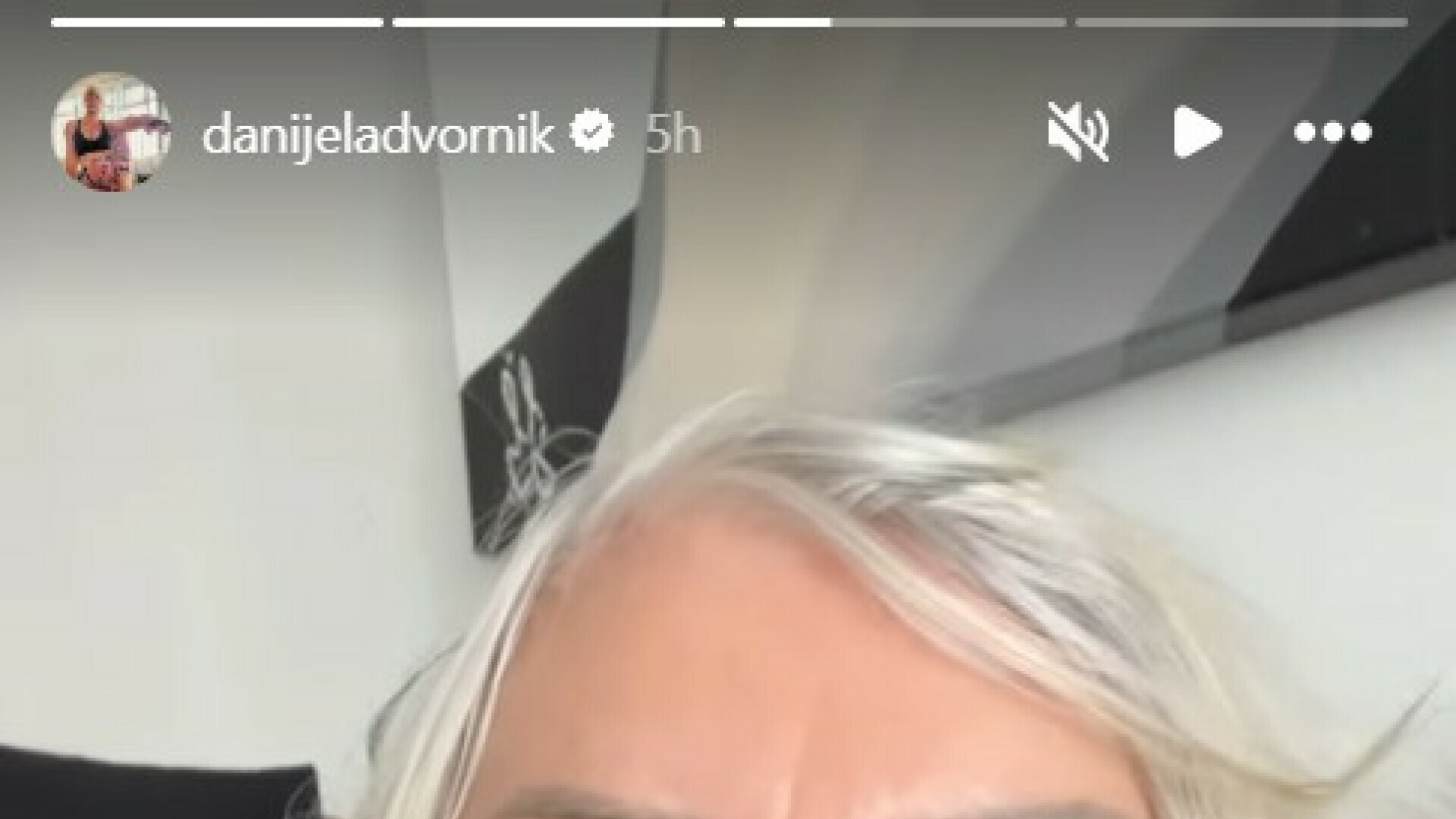 Danijela Dvornik pokazala kako izgleda 16 dana nakon operacije lica ...