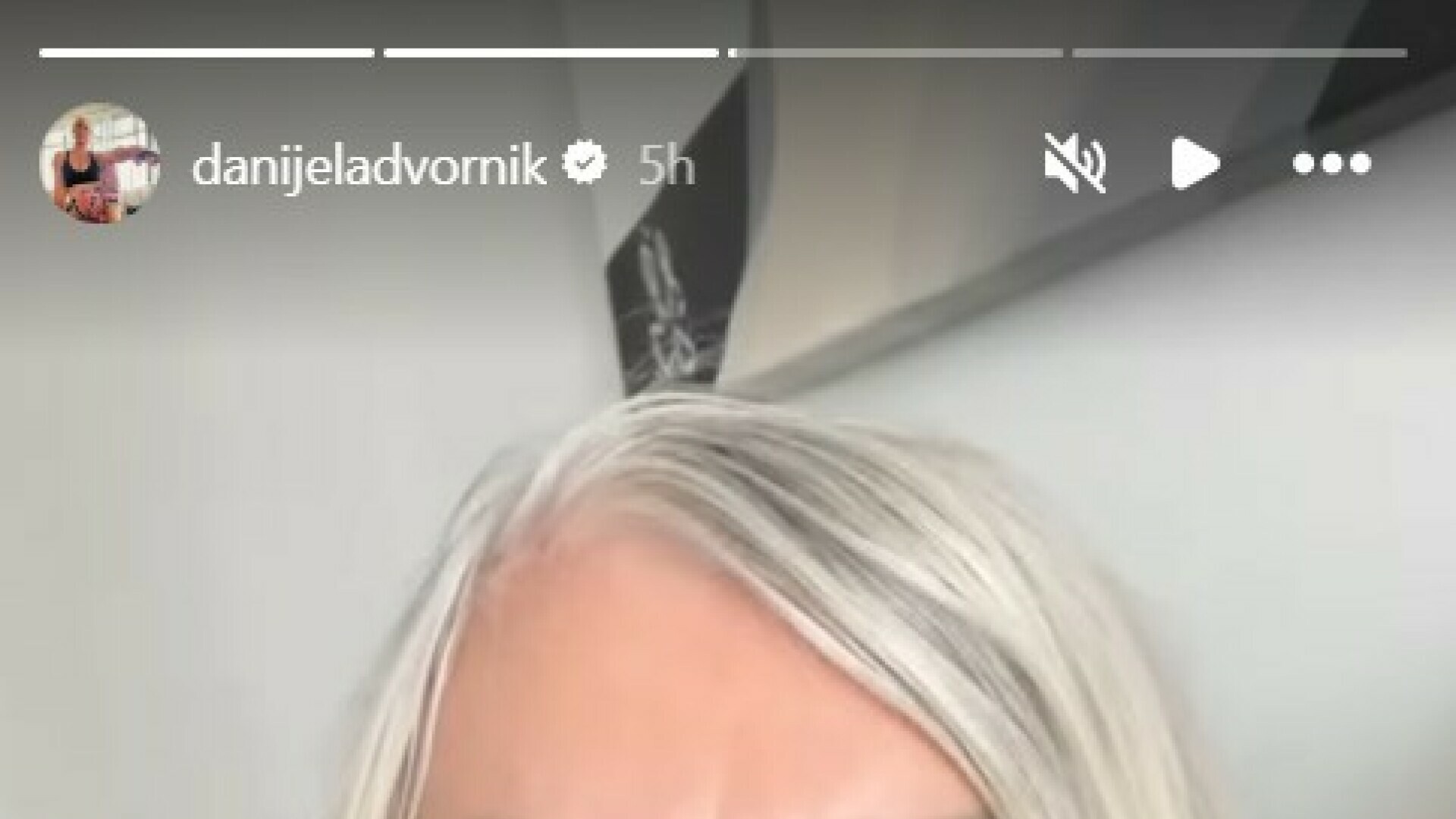 Pratitelji Danijele Dvornik kritiziraju njezin novi izgled lica ...