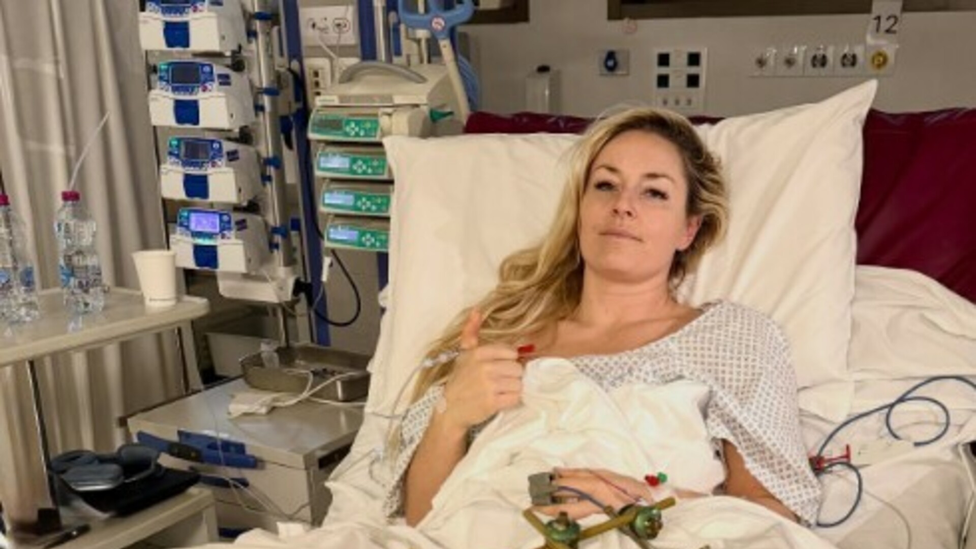 Evo zašto Lindsey Vonn nosi metalni fiksator: Poznati liječnik sve pojasnio