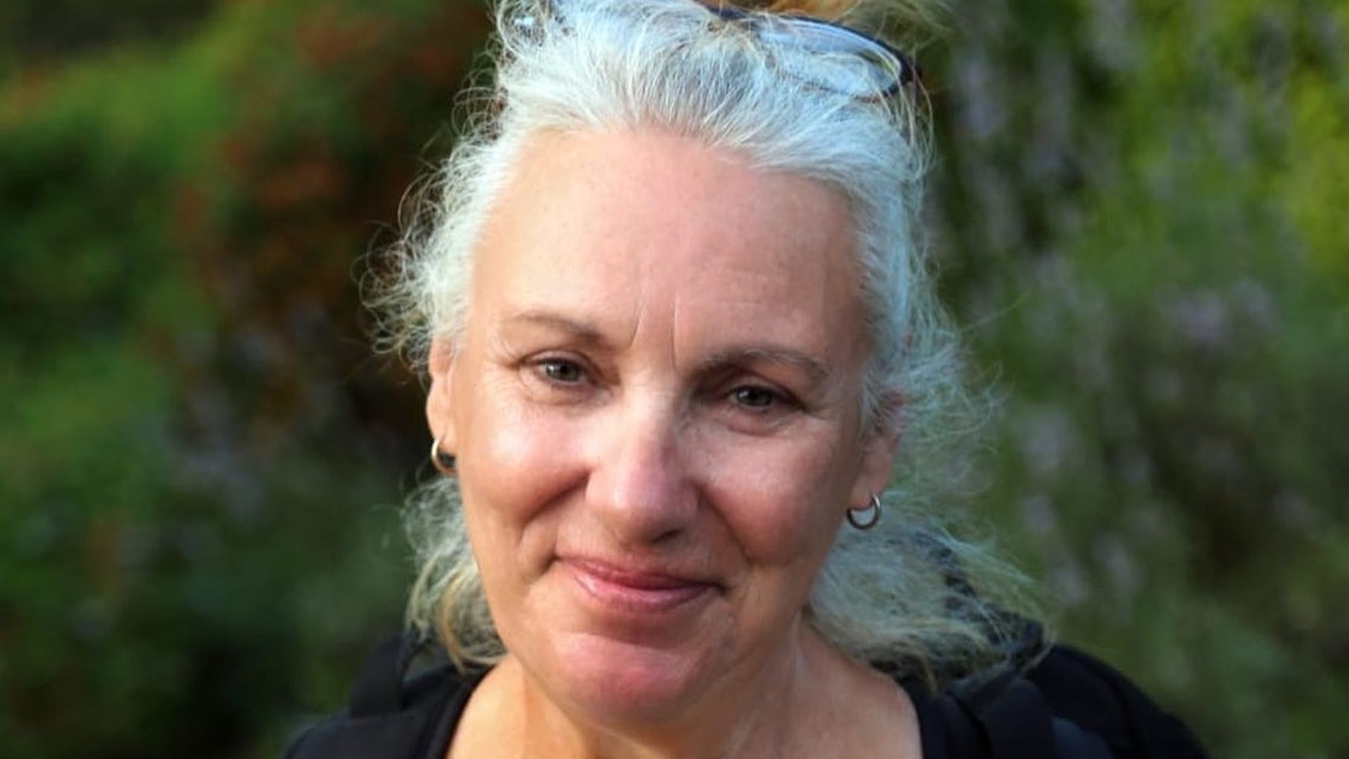 Pas ugrizao prolaznika, vlasnica bi zato mogla ostati bez posla