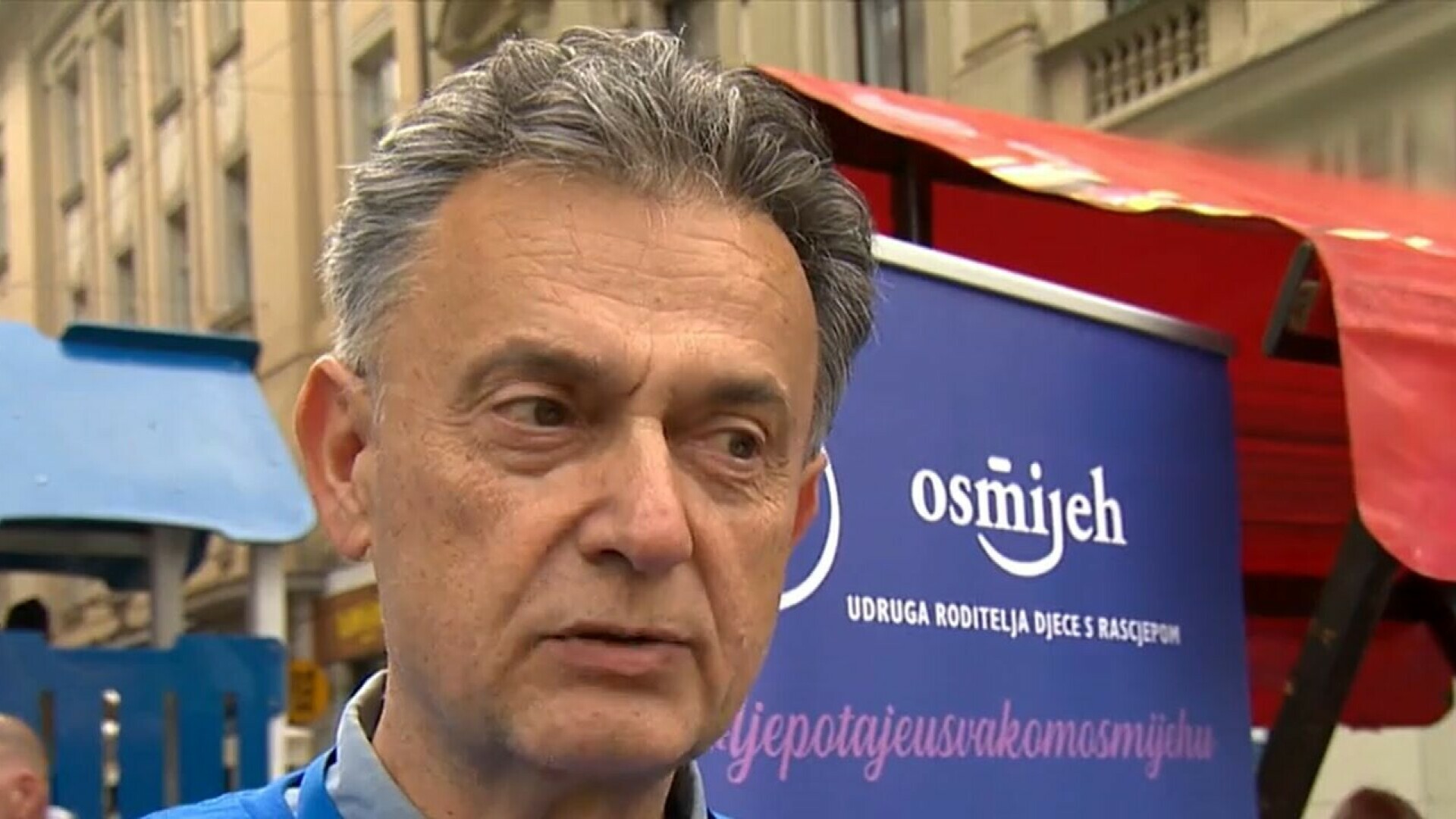 Obilježen tjedan o rascjepima usne ili nepca