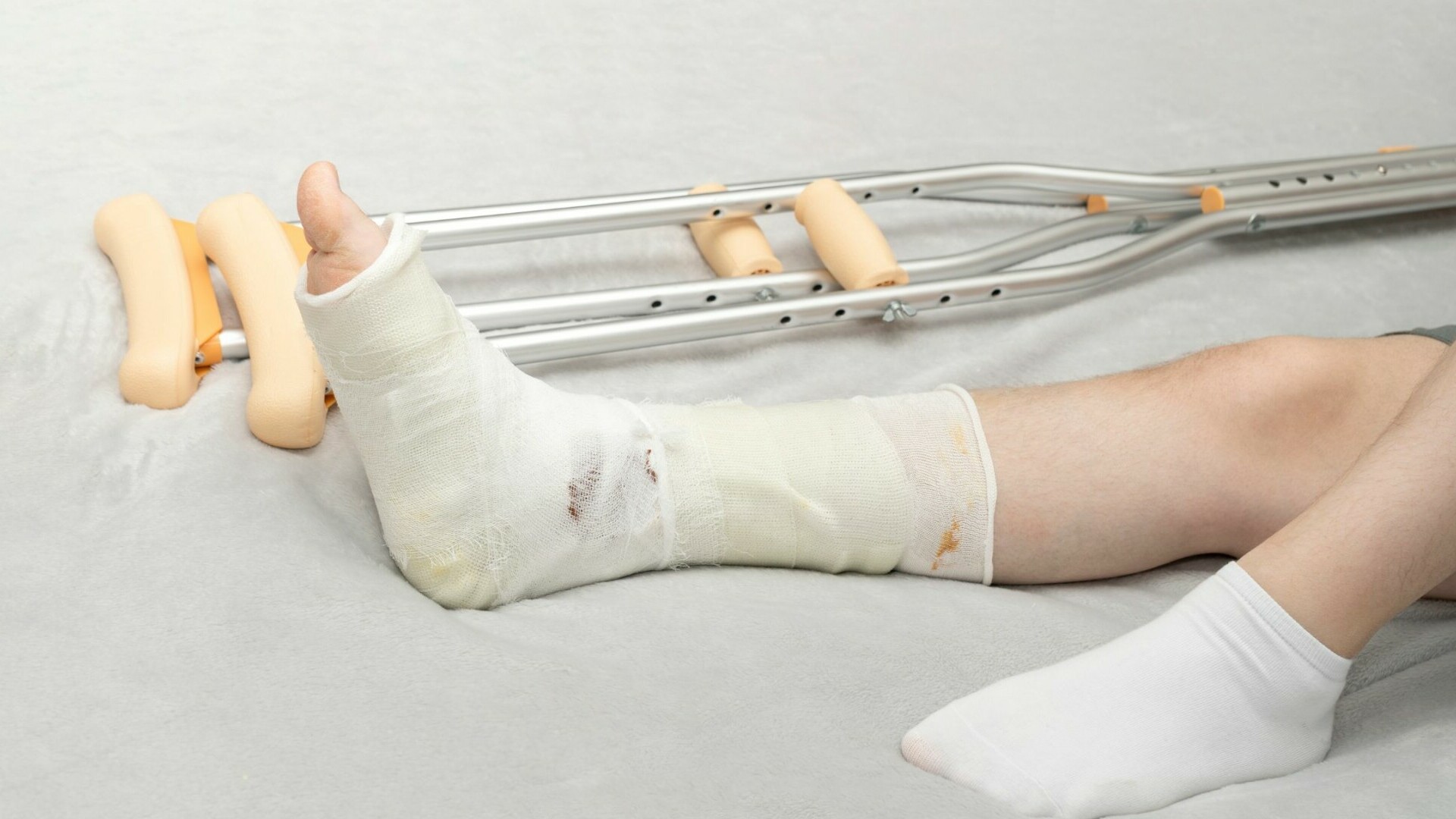 Postoji neobična teorija o ljudima koji nikada nisu slomili kost! Jeste ...