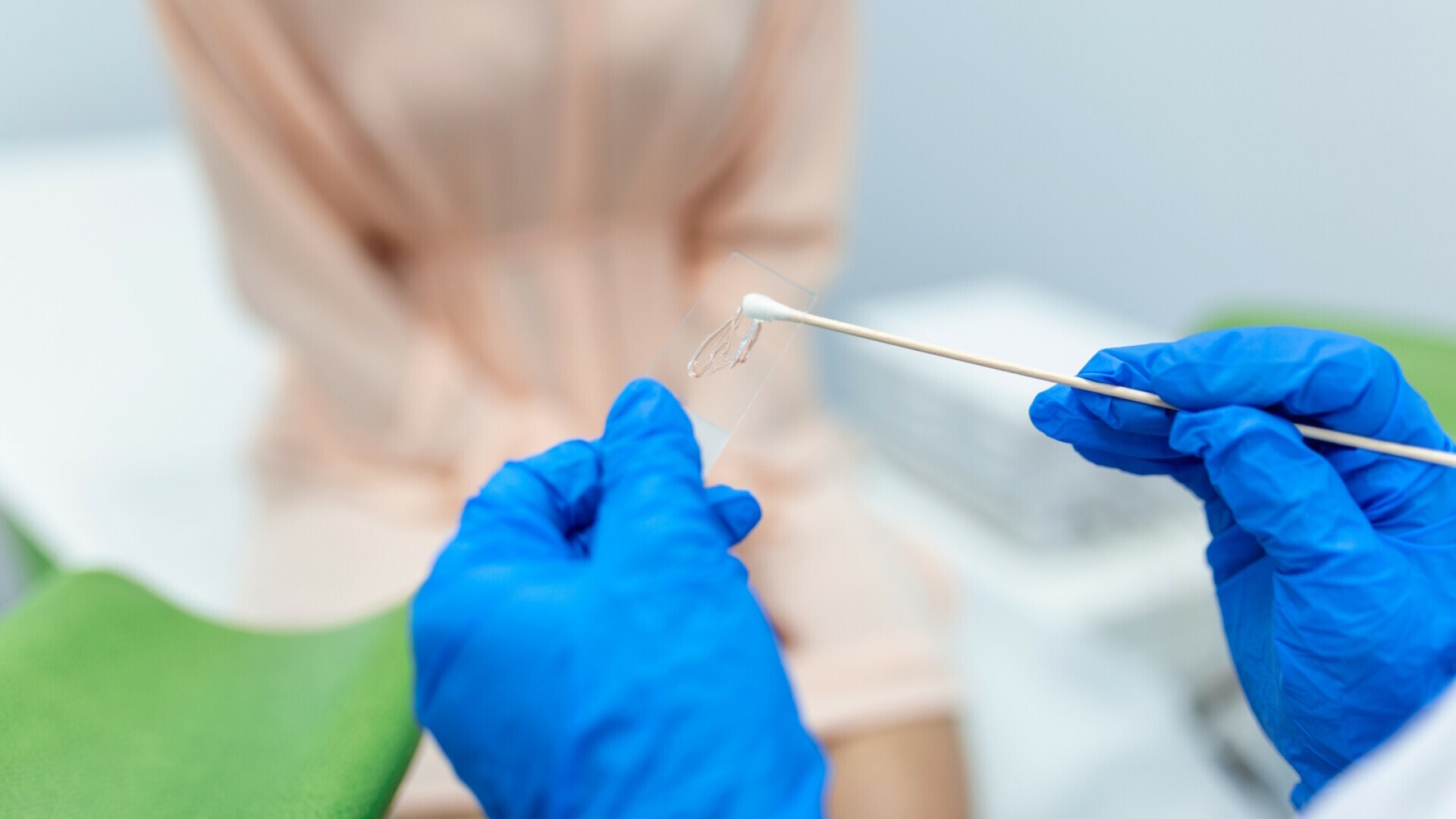 Što znači ako nakon uzimanja brisa za papa-test dođe do krvarenja?