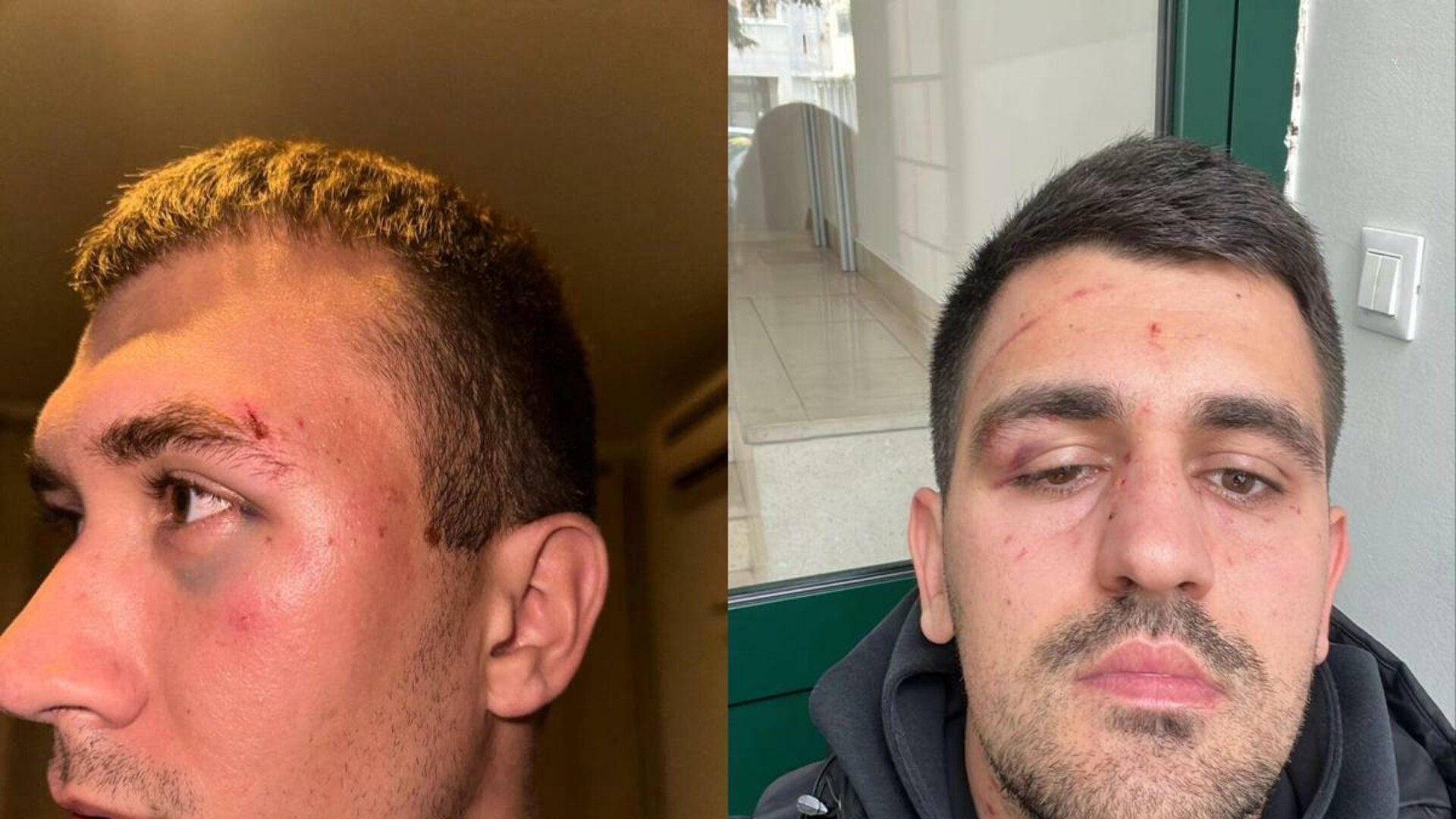 Prebili su nogometaše Metkovića nakon utakmice, a sada im je stigla ...
