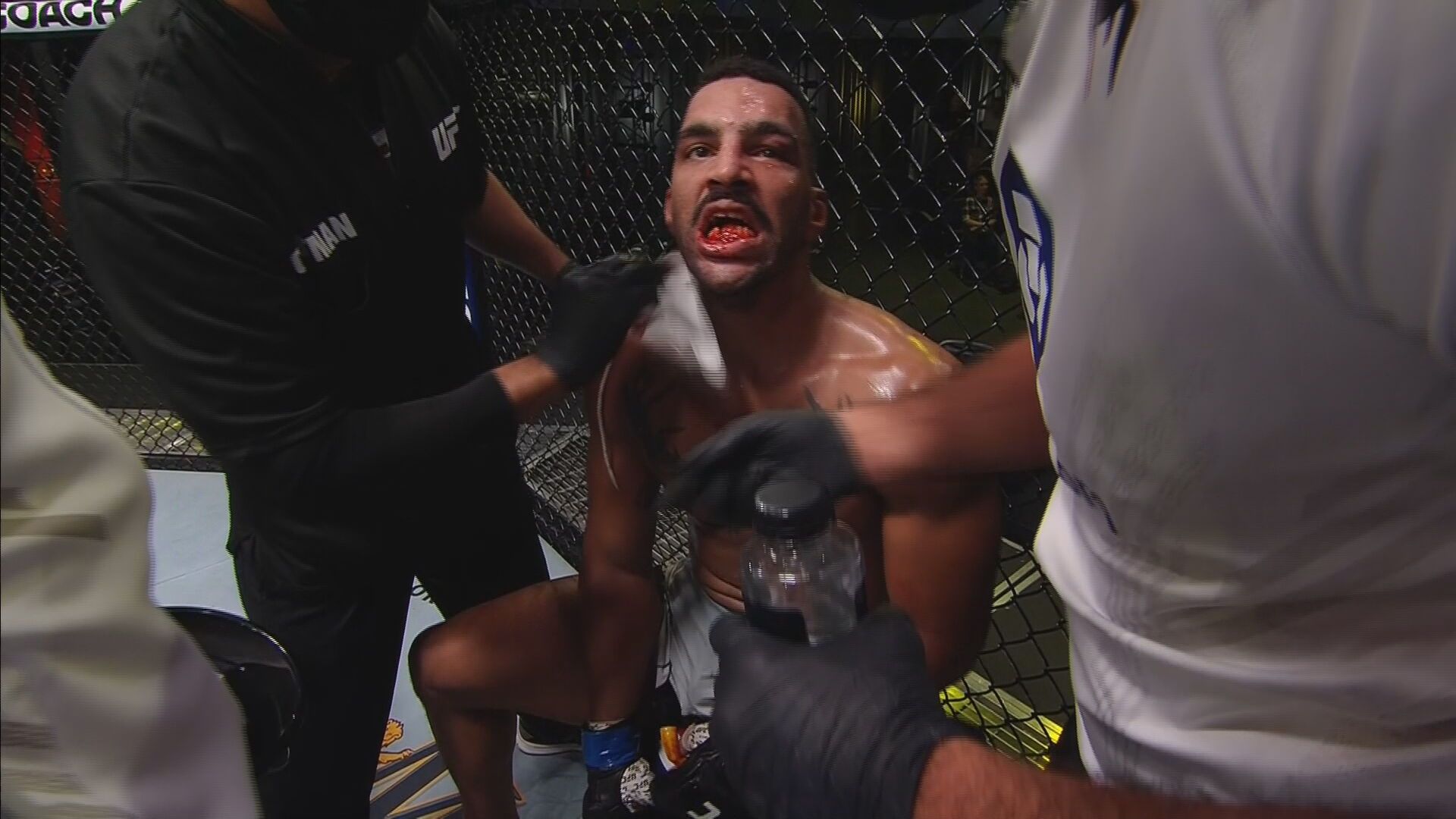 UFC-ov borac s teško unakaženim zubima vratio se u oktogon i nastavio ...