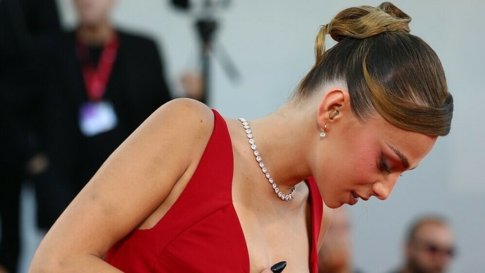 Tko je influencerica s inspirativnom pričom koju je dekolte zamalo izdao pred svima?